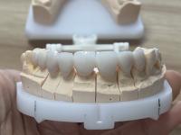 China High Strength All-Zirconia Crowns and Veneers with Natural Tooth-Like Appearance via CAD/CAM Precision Manufacturing for sale