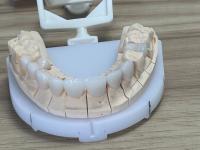 China High Strength All-Zirconia Crowns and Veneers with Natural Tooth-Like Appearance via CAD/CAM Precision Manufacturing for sale