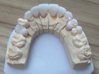 China High Strength All-Zirconia Crowns and Veneers with Natural Tooth-Like Appearance via CAD/CAM Precision Manufacturing for sale