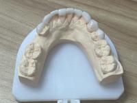 China High Strength All-Zirconia Crowns and Veneers with Natural Tooth-Like Appearance via CAD/CAM Precision Manufacturing for sale