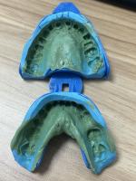 China High Strength All-Zirconia Crowns and Veneers with Natural Tooth-Like Appearance via CAD/CAM Precision Manufacturing for sale
