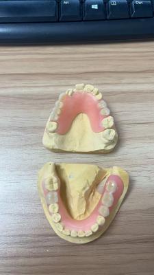 China Flexible Partial Denture with Custom-Made Digital Design and Tooth-Colored Gum-Colored Aesthetic for sale