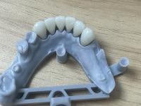 China Full Zirconia Dental Restoration with High Strength Natural Tooth-Like Appearance and Metal-Free Design for sale