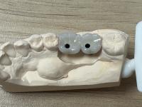China Full Zirconia Implant Crown with High Strength and Wear Resistance Natural Tooth-Like Appearance Using Digital CAD/CAM Technology for sale