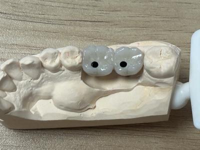 China Full Zirconia Implant Crown with High Strength and Wear Resistance Natural Tooth-Like Appearance Using Digital CAD/CAM Technology for sale