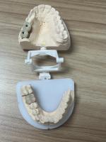 China Full Zirconia Implant Crown with High Strength and Wear Resistance Natural Tooth-Like Appearance Using Digital CAD/CAM Technology for sale