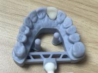 China Custom All-Zirconia Crown with Zirconia Post and Core for Metal-Free Natural Appearance and Precise Fit for sale