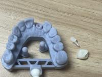 China Custom All-Zirconia Crown with Zirconia Post and Core for Metal-Free Natural Appearance and Precise Fit for sale
