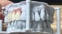 China Customized Full Zirconia Dental Crowns with CAD/CAM Digital Design for High Strength and Durability for sale