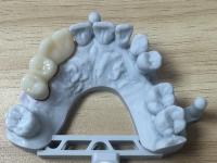 China Customized Full Zirconia Dental Crowns with CAD/CAM Digital Design for High Strength and Durability for sale