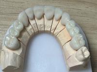 China Custom Monolithic Zirconia Dental Bridge with Digital Design and CAD/CAM Milling for Dental Professionals for sale