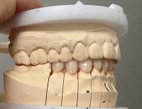 China Custom Full Zirconia Dental Bridge with Digital CAD/CAM Milling and Multiple Tooth Shades for sale