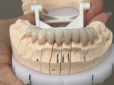 China Custom Full Zirconia Dental Bridge with Digital CAD/CAM Milling and Multiple Tooth Shades for sale