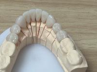 China Custom Full Zirconia Dental Bridge with Digital CAD/CAM Milling and Multiple Tooth Shades for sale