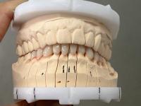 China Custom Full Zirconia Dental Bridge with Digital CAD/CAM Milling and Multiple Tooth Shades for sale