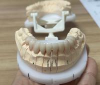 China Custom Full Zirconia Dental Bridge with Digital CAD/CAM Milling and Multiple Tooth Shades for sale