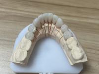 China Custom Full Zirconia Dental Bridge with Digital CAD/CAM Milling and Multiple Tooth Shades for sale