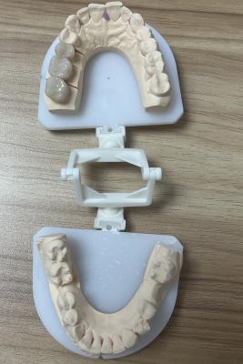 China Custom Full Zirconia Dental Bridge with Digital CAD/CAM Milling and Monolithic Zirconia Structure in Multiple Tooth Shades for sale