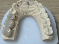 China Custom Full Zirconia Dental Bridge with Digital CAD/CAM Milling and Monolithic Zirconia Structure in Multiple Tooth Shades for sale