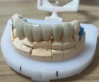 China Cobalt-Chromium Alloy Porcelain-Fused-to-Metal Dental Bridge with Natural Tooth-Colored Porcelain Customized to Patient-Specific Dental Requirements for sale