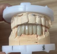 China Cobalt-Chromium Alloy Porcelain-Fused-to-Metal Dental Bridge with Natural Tooth-Colored Porcelain Customized to Patient-Specific Dental Requirements for sale