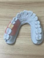 China Lightweight Comfortable Discreet Appearance Flexible Removable Denture and Invisible Removable Denture Base for sale