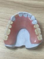 China Lightweight Comfortable Discreet Appearance Flexible Removable Denture and Invisible Removable Denture Base for sale