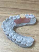 China Lightweight Comfortable Discreet Appearance Flexible Removable Denture and Invisible Removable Denture Base for sale