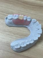 China Lightweight Comfortable Discreet Appearance Flexible Removable Denture and Invisible Removable Denture Base for sale