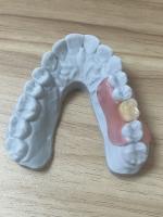 China Lightweight Comfortable Discreet Appearance Flexible Removable Denture and Invisible Removable Denture Base for sale