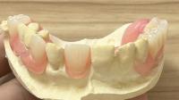 China Lightweight Comfortable Discreet Appearance Removable Denture Base and Flexible Denture Base for Esthetic Partial Dentures for sale