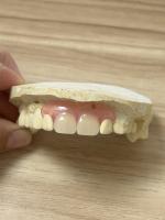 China Lightweight Comfortable Discreet Appearance Removable Denture Base and Flexible Denture Base for Esthetic Partial Dentures for sale