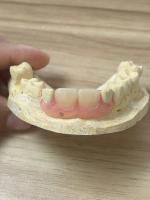 China Lightweight Comfortable Discreet Appearance Removable Denture Base and Flexible Denture Base for Esthetic Partial Dentures for sale