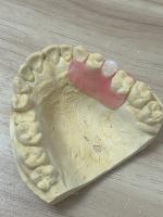 China Lightweight Comfortable Discreet Appearance Removable Denture Base and Flexible Denture Base for Esthetic Partial Dentures for sale