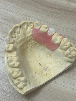 China Lightweight Comfortable Discreet Appearance Removable Denture Base and Flexible Denture Base for Esthetic Partial Dentures for sale