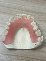 China Lightweight Comfortable Discreet Appearance Removable Denture Base and Flexible Denture Base for Esthetic Partial Dentures for sale