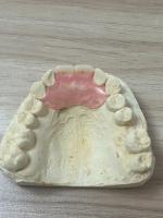 China Lightweight Comfortable Discreet Appearance Removable Denture Base and Flexible Denture Base for Esthetic Partial Dentures for sale