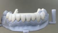 China Custom Fit Ceramic Veneers with Natural Appearance and Esthetic Finish for Dental Restorations for sale