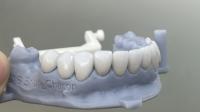China Custom Fit Ceramic Veneers with Natural Appearance and Esthetic Finish for Dental Restorations for sale