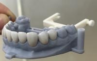 China Custom Fit Ceramic Veneers with Natural Appearance and Esthetic Finish for Dental Restorations for sale