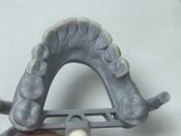 China Custom Fit Ceramic Veneers with Natural Appearance and Esthetic Finish for Dental Restorations for sale