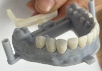 China Custom Fit Ceramic Veneers with Natural Appearance and Esthetic Finish for Dental Restorations for sale