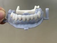 China Custom Fit Ceramic Veneers with Natural Appearance and Esthetic Finish for Dental Restorations for sale