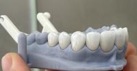 China Natural-Looking Esthetics Ceramic Veneers with Customized Tooth Shape and Precise Laboratory Fabrication for sale