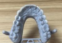 China Natural-Looking Esthetics Ceramic Veneers with Customized Tooth Shape and Precise Laboratory Fabrication for sale