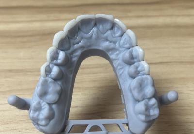 China Natural-Looking Esthetics Ceramic Veneers with Customized Tooth Shape and Precise Laboratory Fabrication for sale