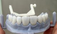 China Natural-Looking Esthetics Ceramic Veneers with Customized Tooth Shape and Precise Laboratory Fabrication for sale