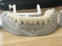 China Metal-Free Full Zirconia Dental Bridge with High Strength and Natural Appearance for Custom Zirconia Dental Bridge Restorations for sale