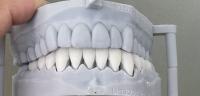 China Metal-Free Full Zirconia Dental Bridge with High Strength and Natural Appearance for Custom Zirconia Dental Bridge Restorations for sale