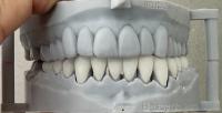 China Metal-Free Full Zirconia Dental Bridge with High Strength and Natural Appearance for Custom Zirconia Dental Bridge Restorations for sale